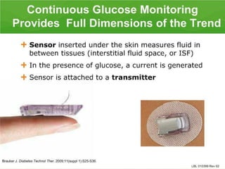 Real time continuous glucose monitoring | PDF