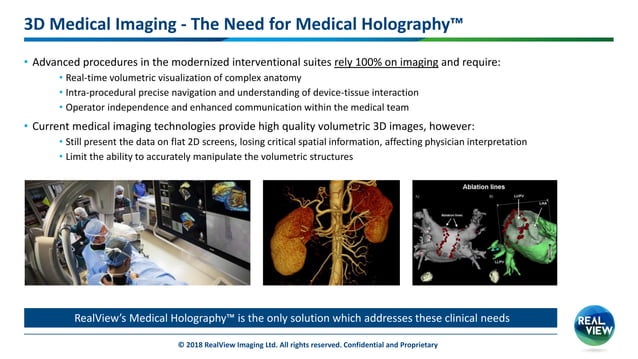 RealView-Imaging-Presentation-project.pdf