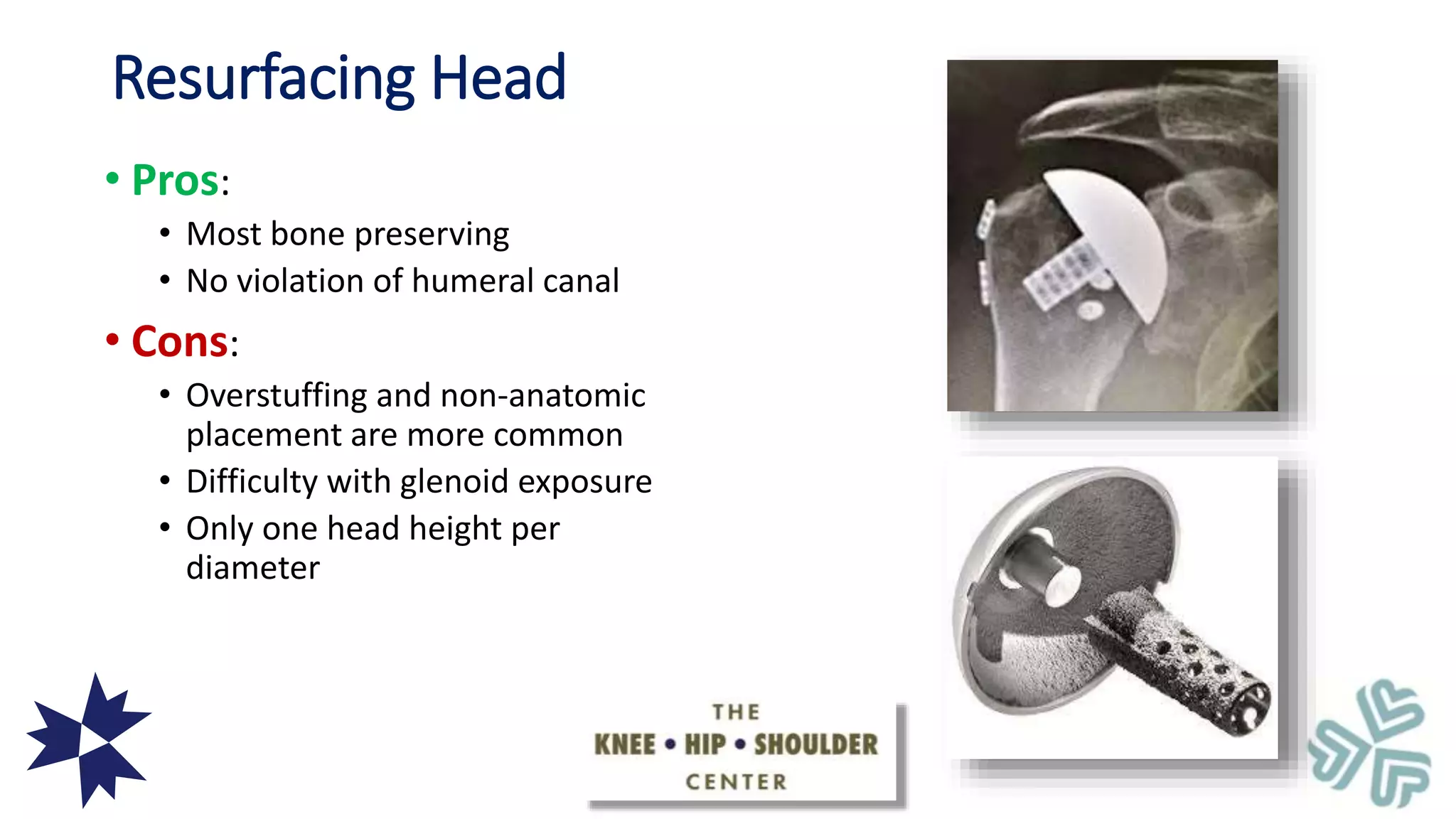 Ream and run patient guide | PPTX | Bone and Joint Conditions ...