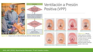 Reanimación Neonatal.pptx