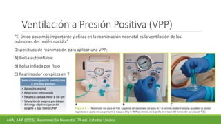 Reanimación Neonatal.pptx