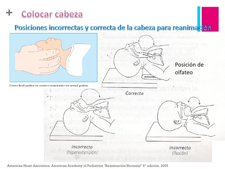 Reanimación neonatal 1,2,3