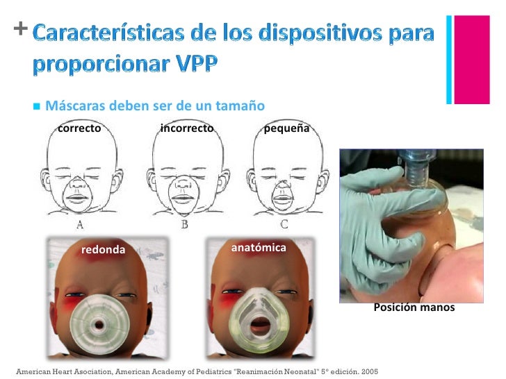 Reanimación neonatal 1,2,3