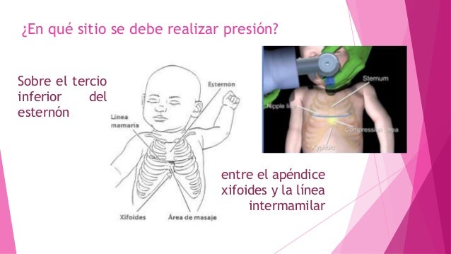 Reanimación neonatal Ecuador MSP