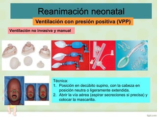 Reanimación neonatal | PPTX