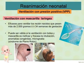 Reanimación neonatal | PPTX