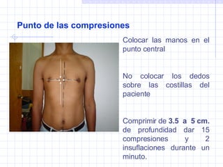reanimacion cardiopulmonar RCP | PPT