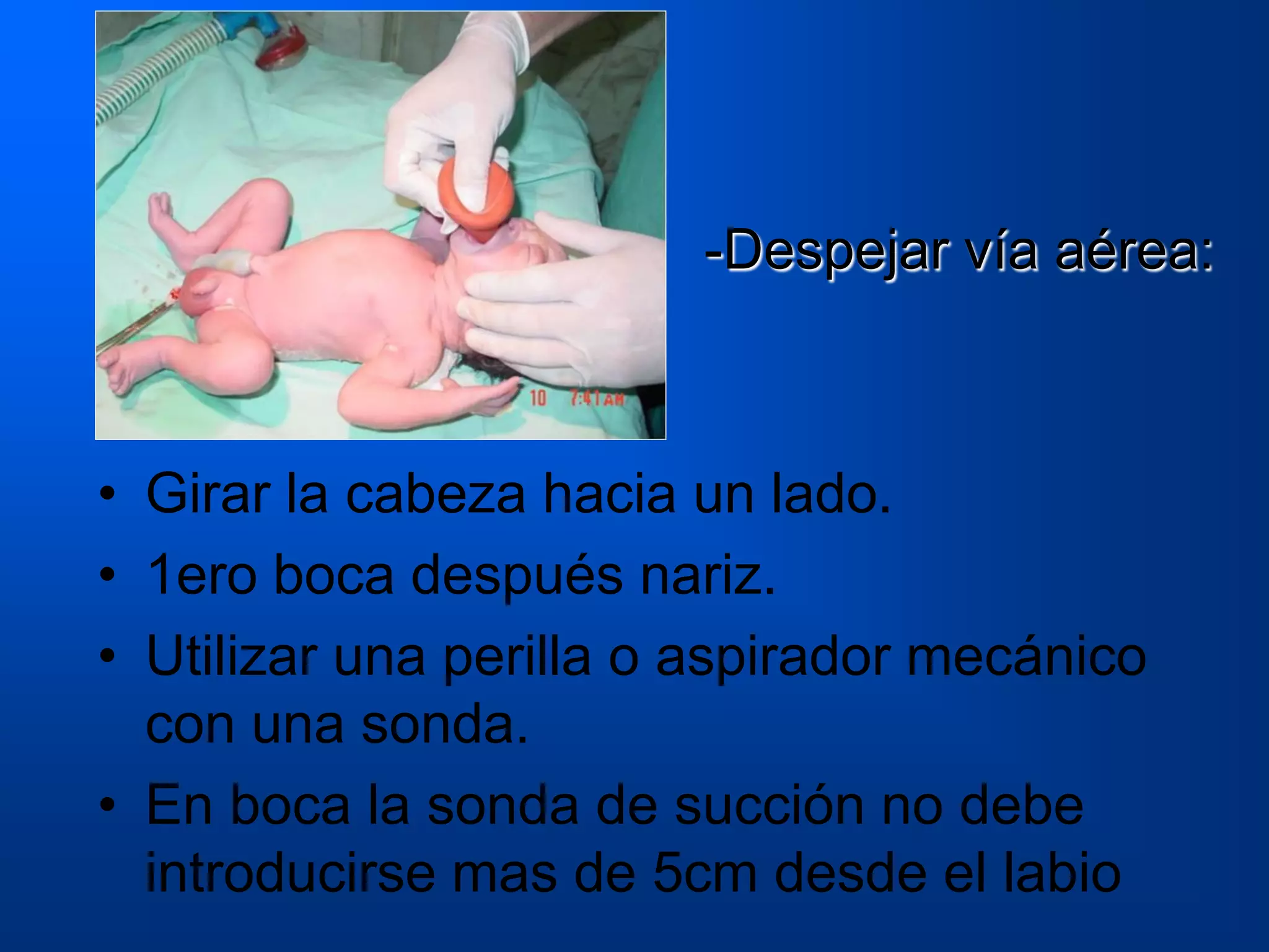 Reanimacion Neonatal Pdf | PDF