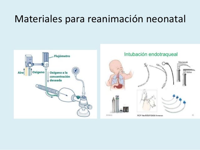 Reanimacion neonatal