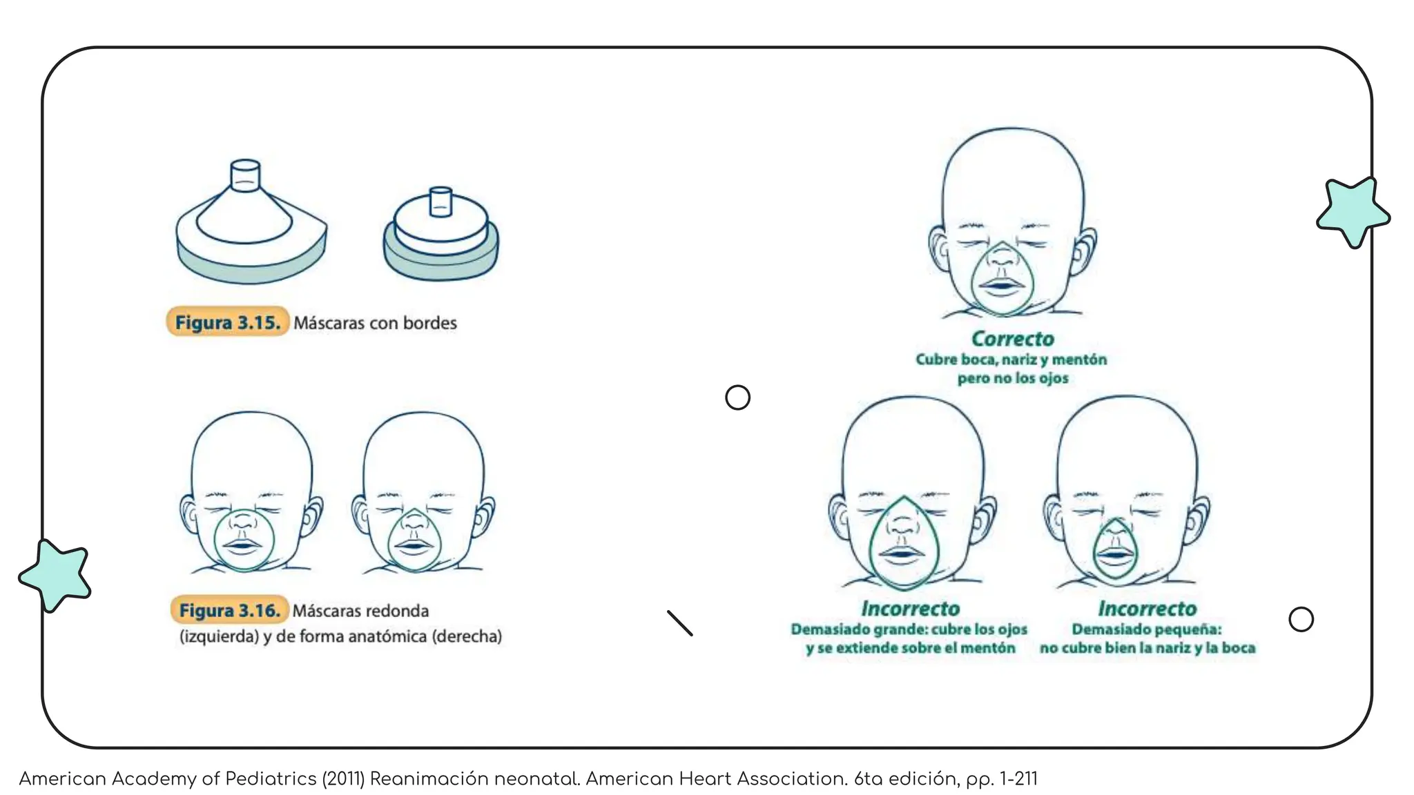 Reanimación neonatal PEDIATRIA, AMERICAN HEART ASSOCIATION .pptx