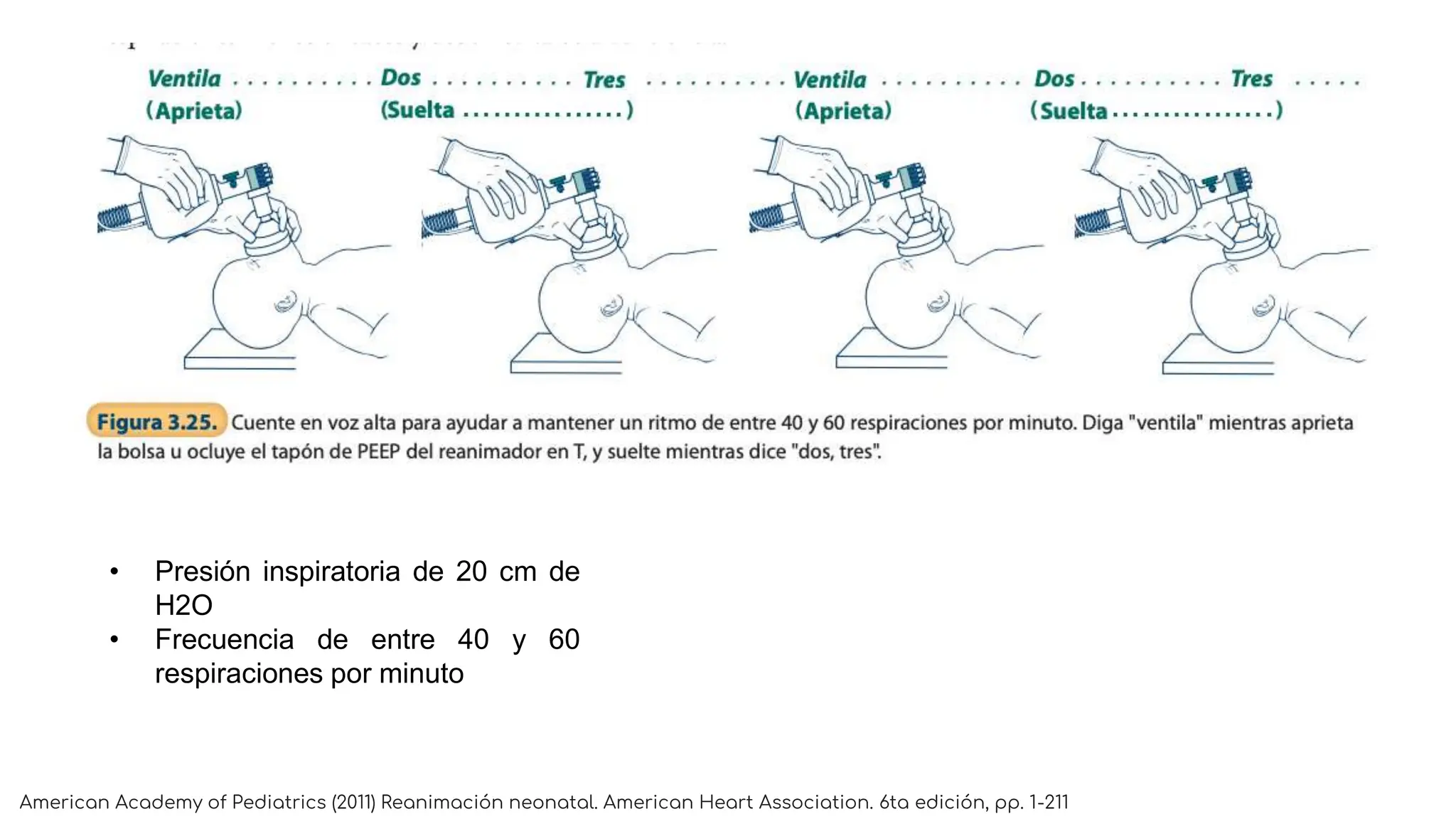 Reanimación neonatal PEDIATRIA, AMERICAN HEART ASSOCIATION .pptx
