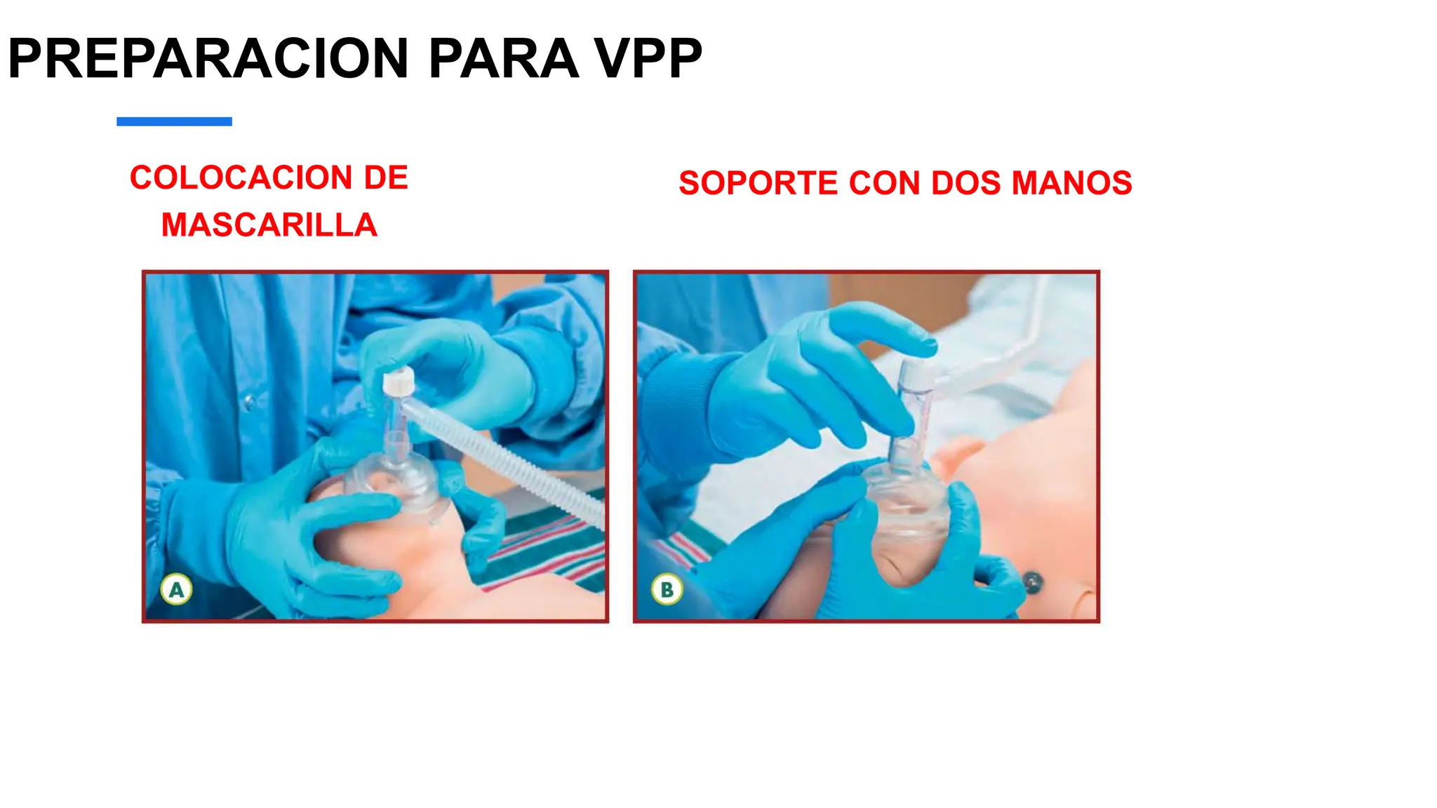 REANIMACION NEONTAL-Ventilacion a presion positiva | PPTX
