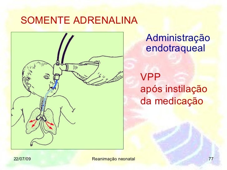 Reanimacao Neonatal
