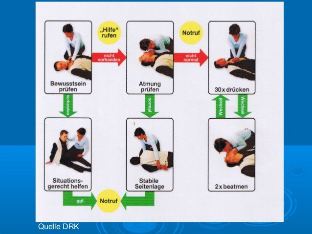 Reanimation basic life support