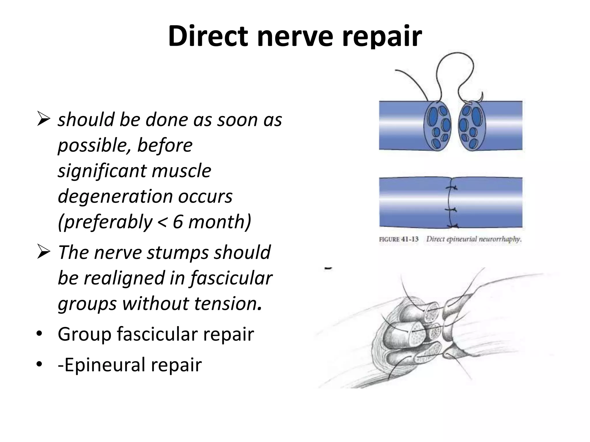 Reanimation of facial paralysis | PPTX