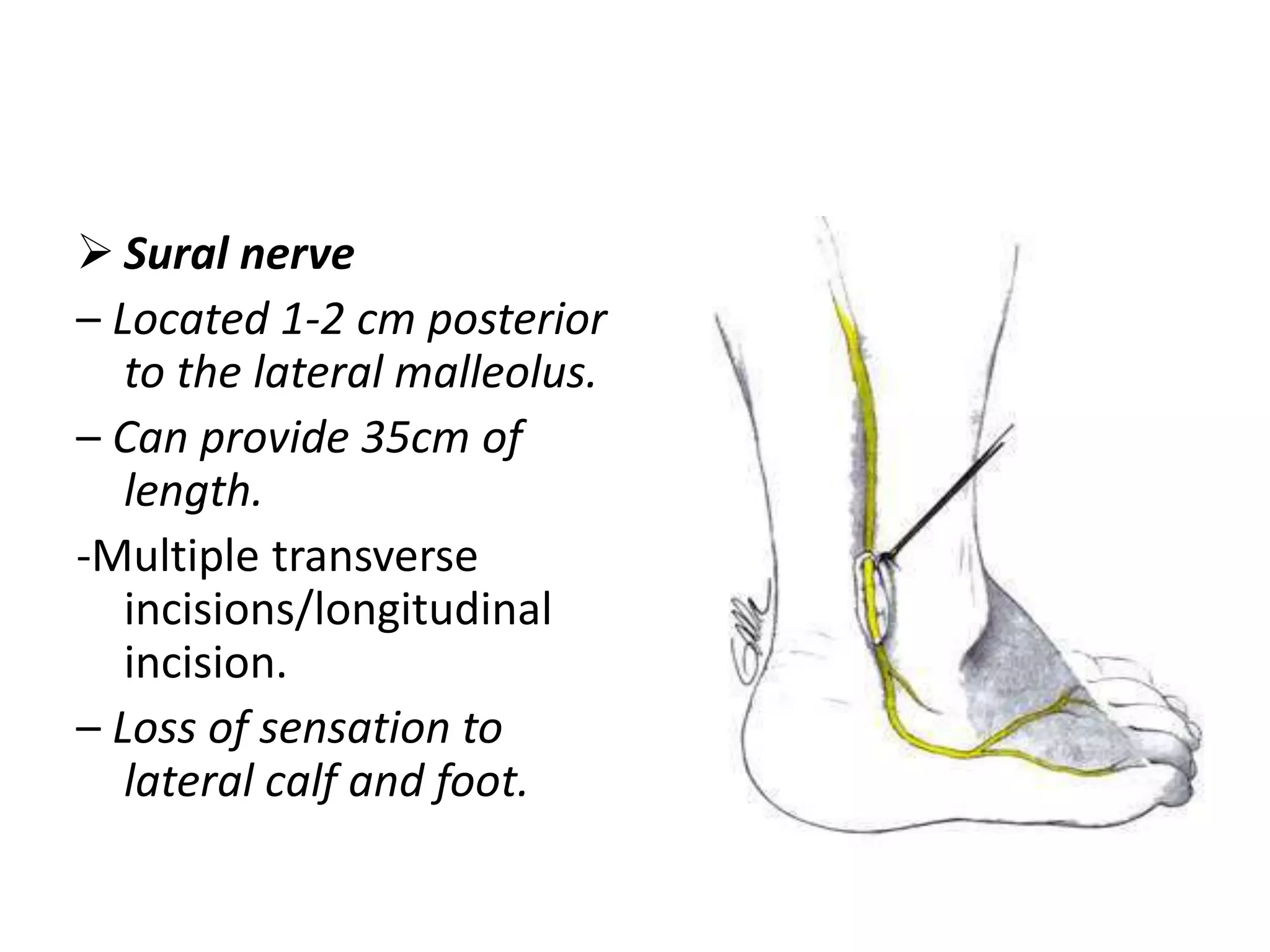 Reanimation of facial paralysis | PPTX