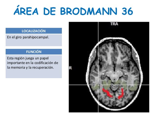 Areas de Brodmann