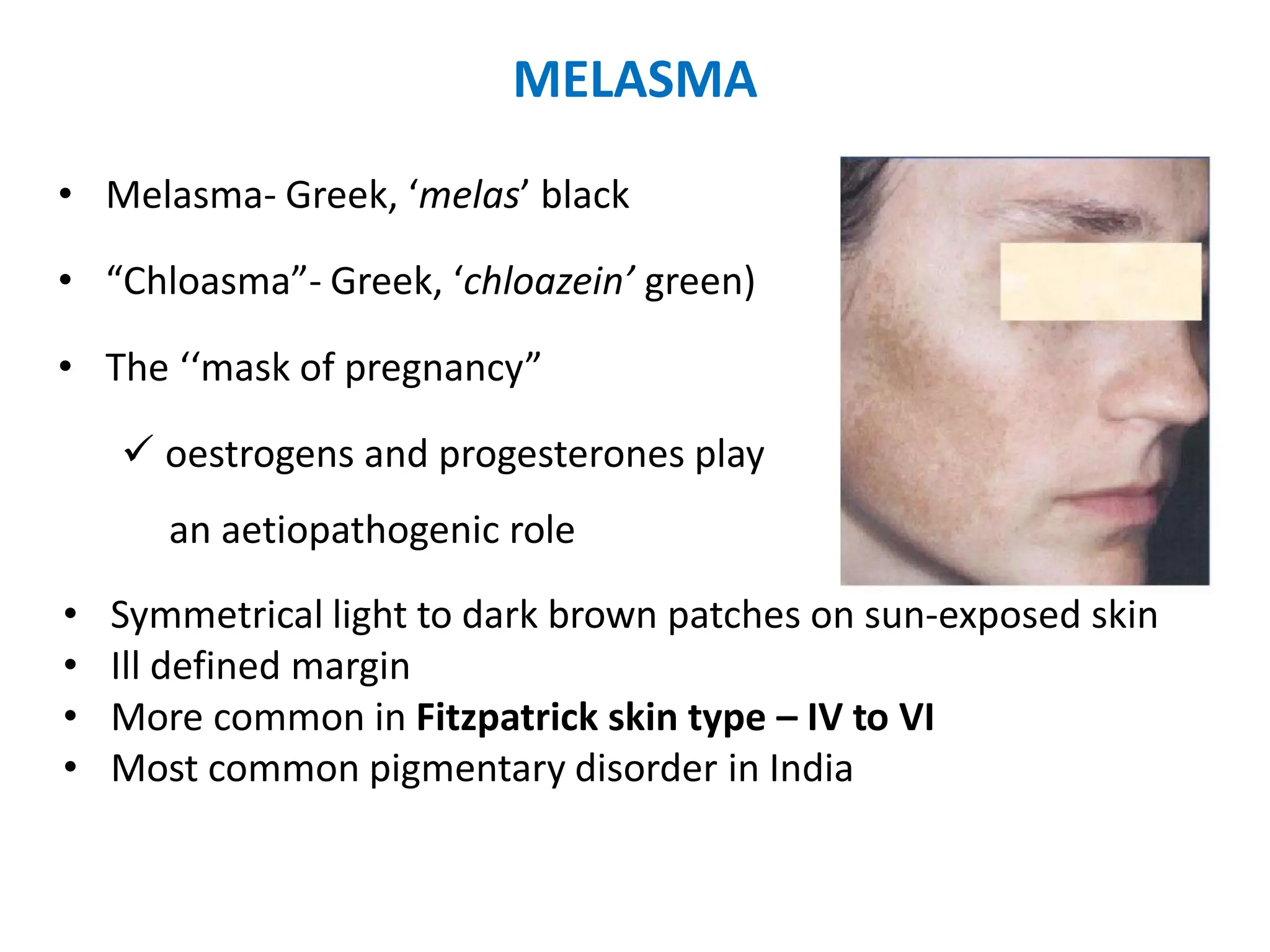 RECALCITRANT MELASMA IN DERMATOLOGY TREATMENT | PPT