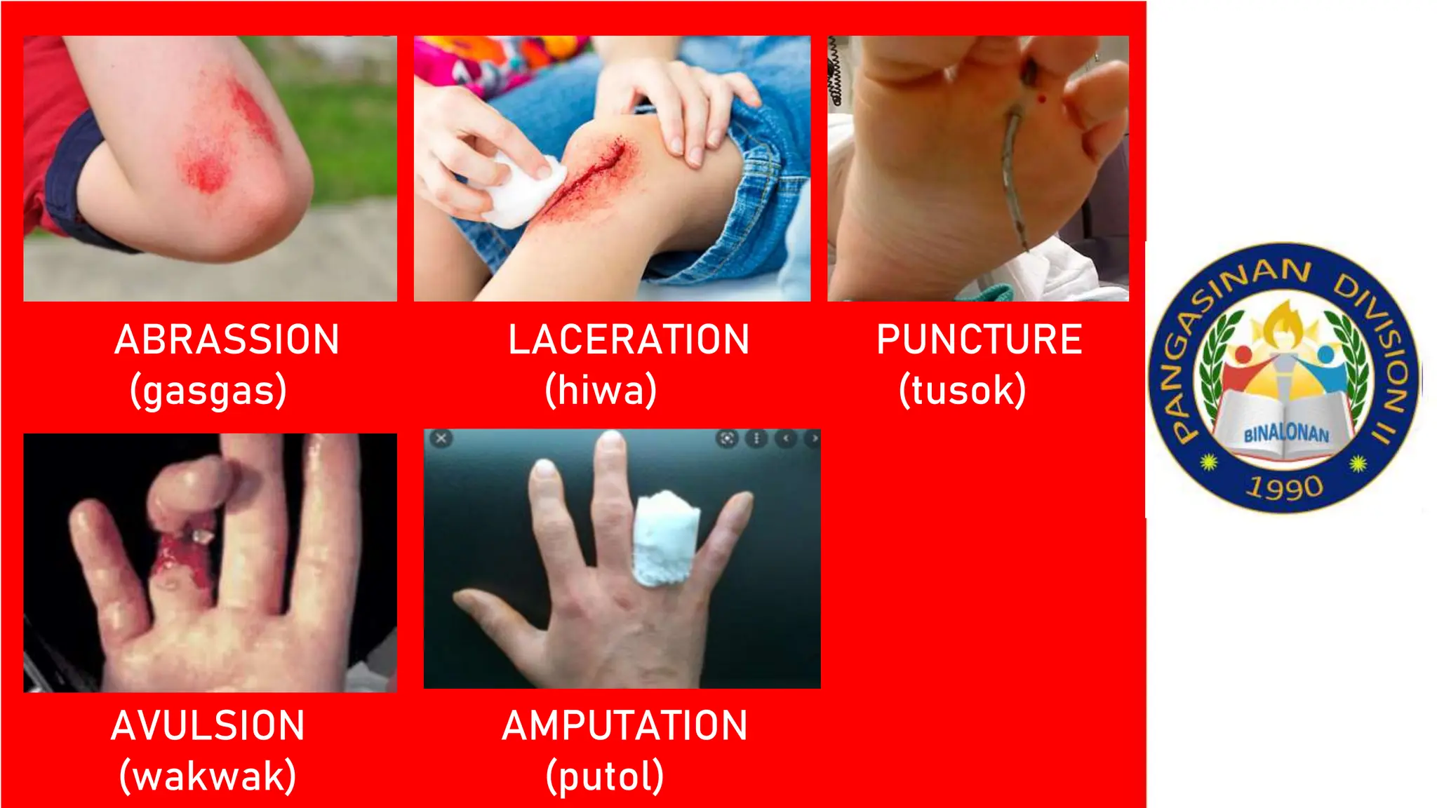 Recall All About Wounds, Open wounds, Close wounds | PPTX