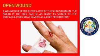 Recall All About Wounds, Open wounds, Close wounds | PPTX | First Aid ...