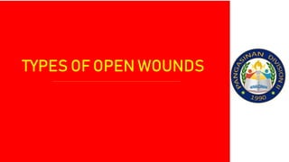 Recall All About Wounds, Open wounds, Close wounds | PPTX
