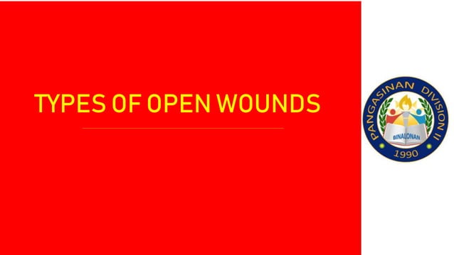 Recall All About Wounds, Open wounds, Close wounds | PPT