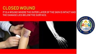 Recall All About Wounds, Open wounds, Close wounds | PPTX | First Aid ...