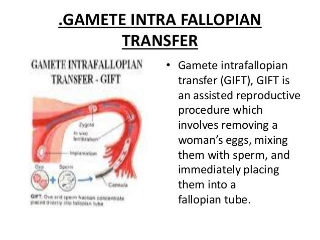 Recent advancement in infertility final ppt