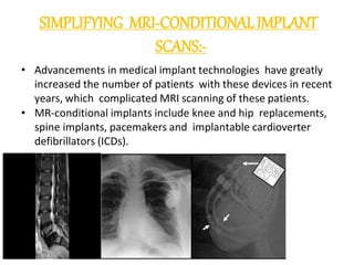 Recent advancement in MRI | PPTX