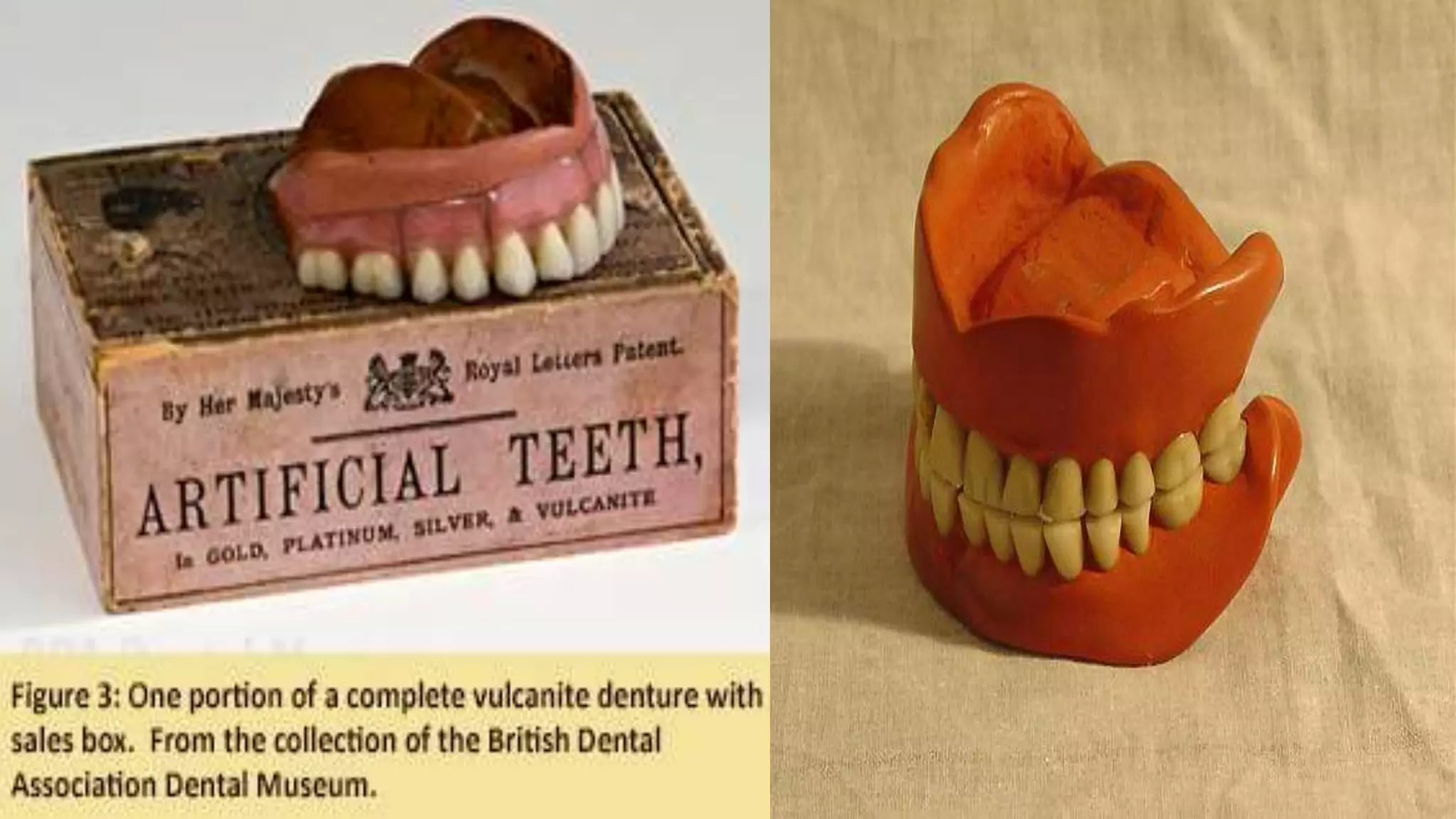 Recent advancements in denture base materials [autosaved] | PPTX