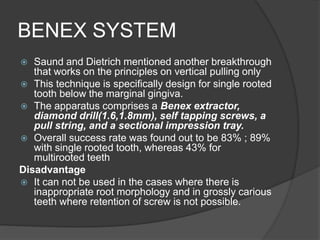 Recent advancements in procedures of atraumatic extraction of teeth | PPTX
