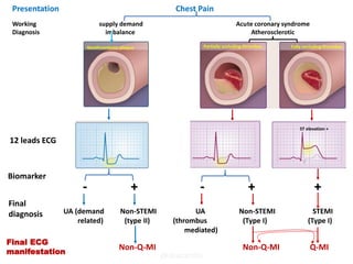 Classification Of Acute Coronary Syndromes (ACS) Acute, 47% OFF