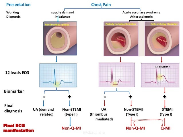 Updates in management of Acute coronary syndrome