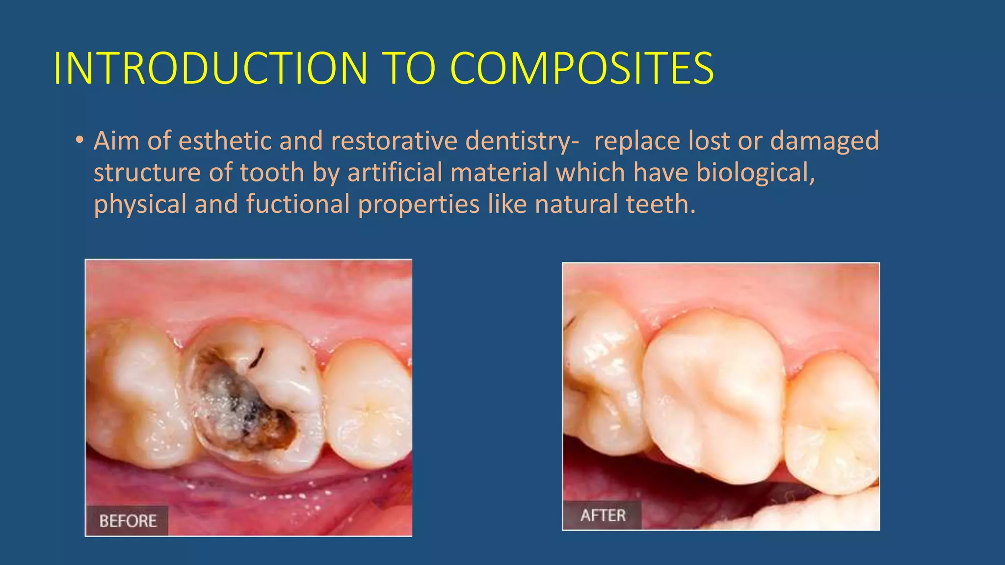 RECENT ADVANCES AND DEVELOPMENTS IN COMPOSITE DENTAL RESTORATIVE ...