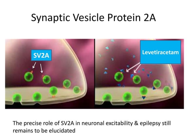 Recent advances epilepsy | PPT