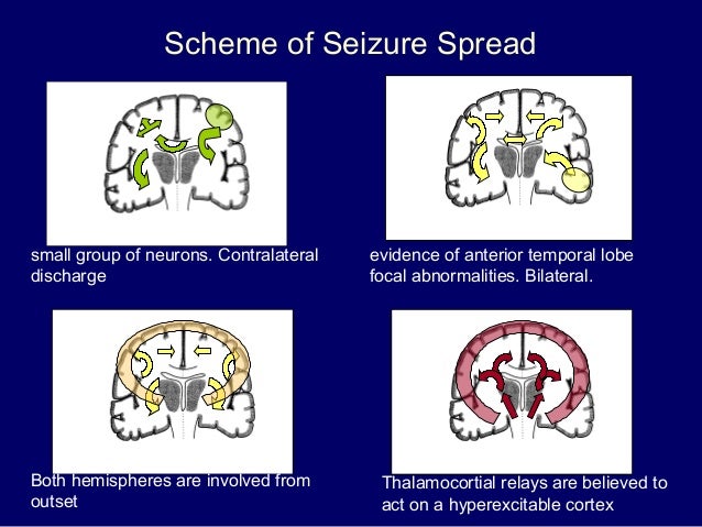 Recent Advances Epilepsy