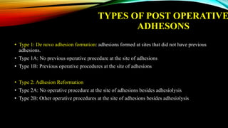 Recent advances in adhesion prevention post laparoscopic surgery.pptx