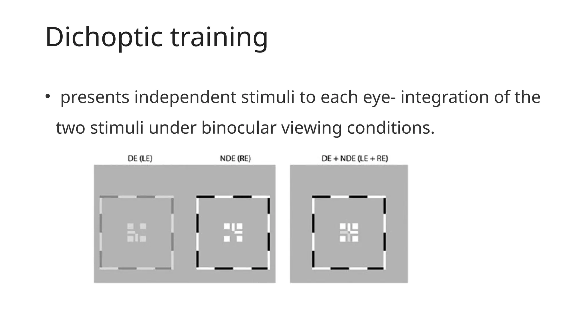 RECENT ADVANCES IN AMBLYOPIA TREATMENT AND PLEOPTICS PPT.pptx