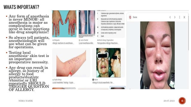 Recent advances in anesthesia and painless surgeries.pptx | First Aid ...