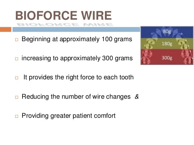 Recent advances in arch wires