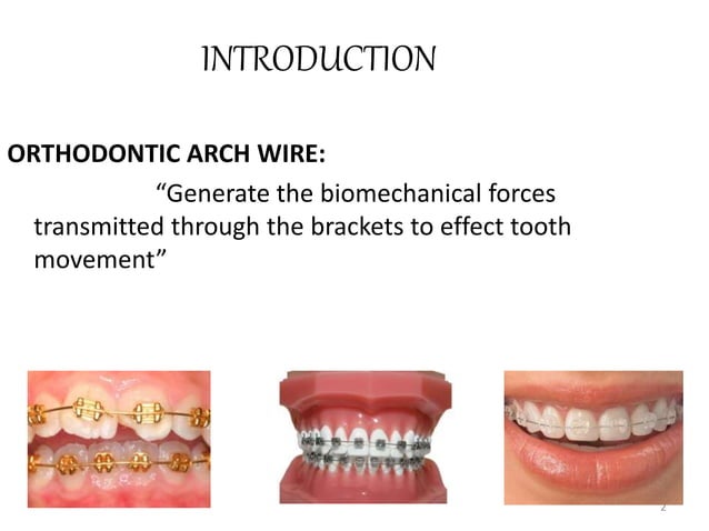 Recent advances in arch wires.pptx | Dental Health | Diseases and ...