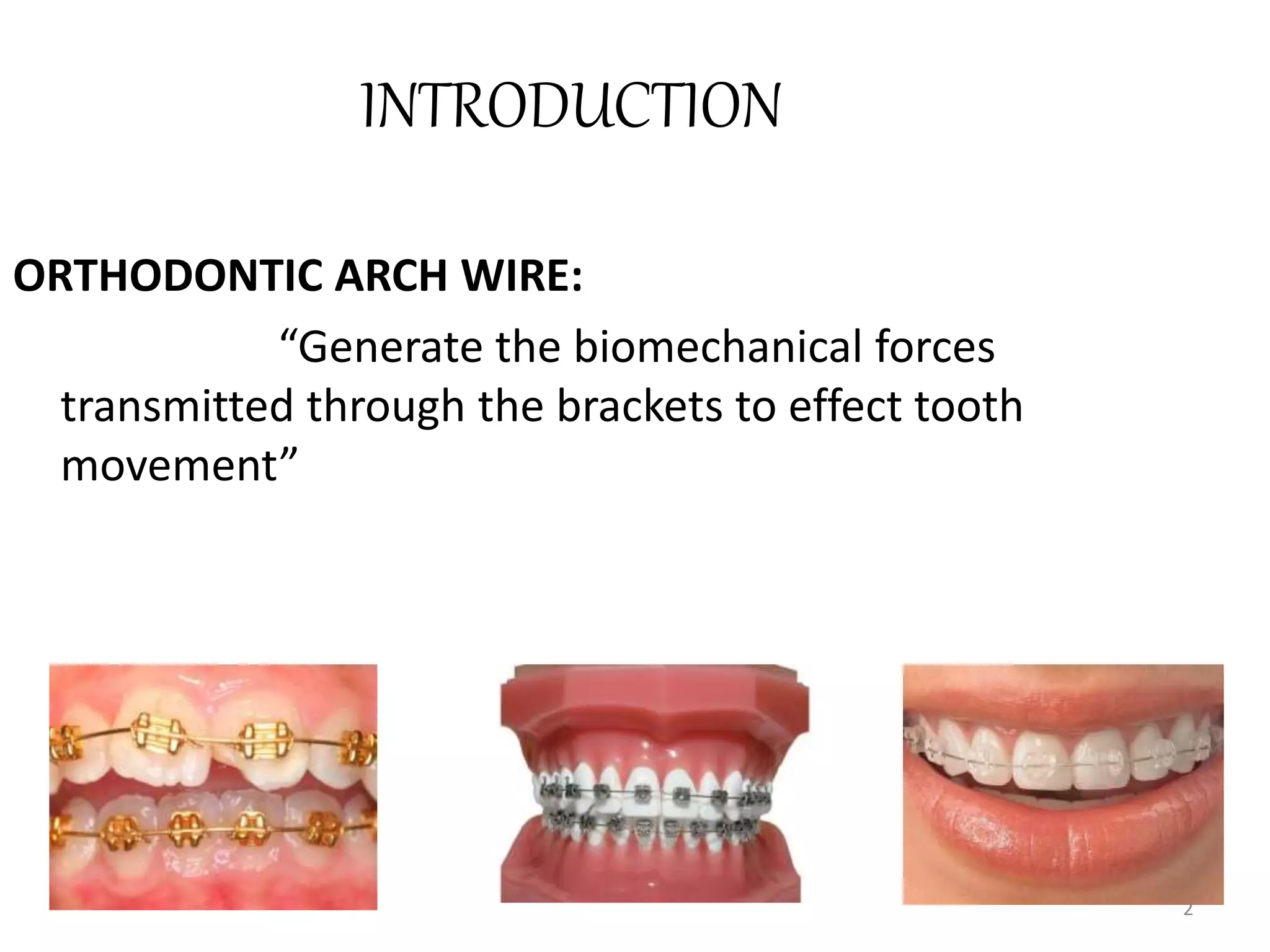 Recent advances in arch wires.pptx