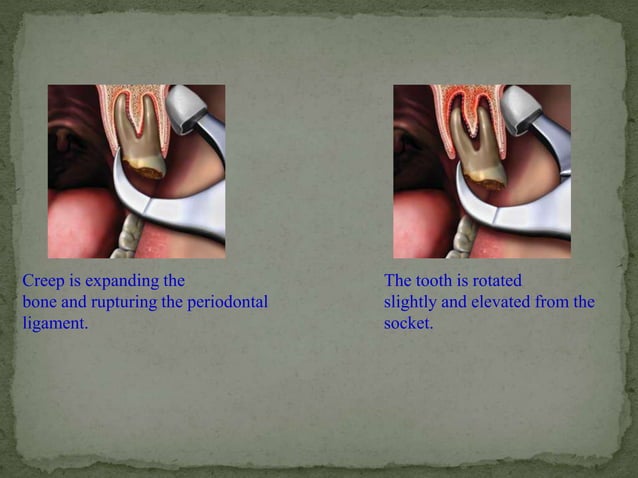 Recent advances in atrumatic extraction techniques | PPTX