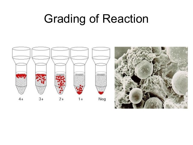 Recent advances in blood banking