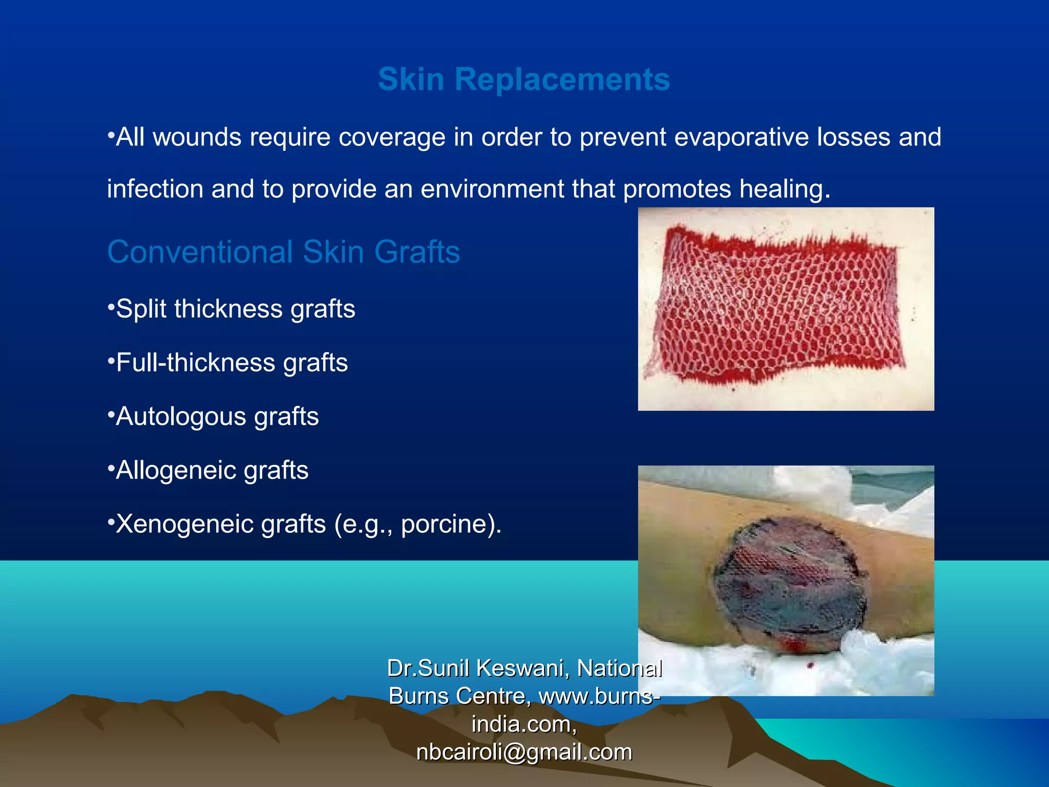 Recent advances in burns management by Dr. Sunil Keswani, National ...