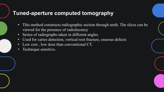 Recent advances in caries diagnosis | PPTX