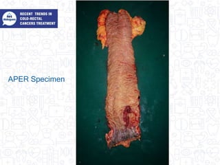 Recent advances in colo-rectal cancers treatment | PPTX