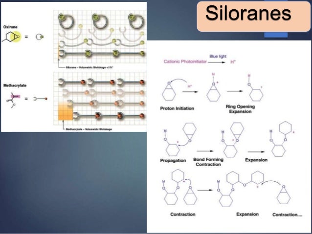 Recent advances in Dental Composites | PPTX