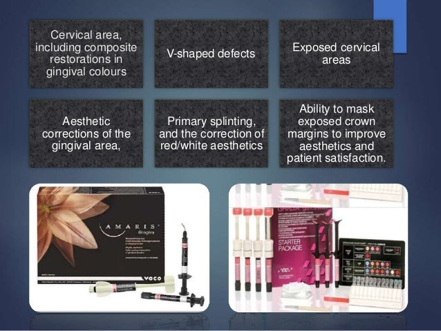Recent advances in Dental Composites | PPTX