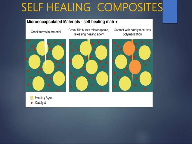 Recent advances in Dental Composites | PPTX